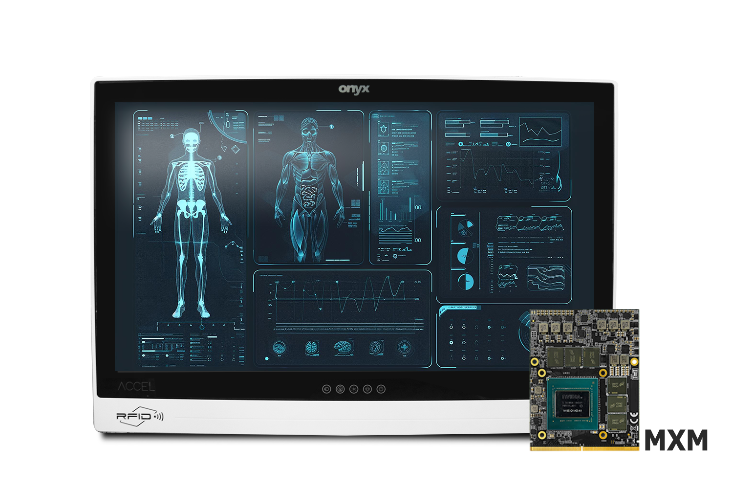ACCEL-A3220 | Medical AI Computer | Onyx Healthcare Inc.