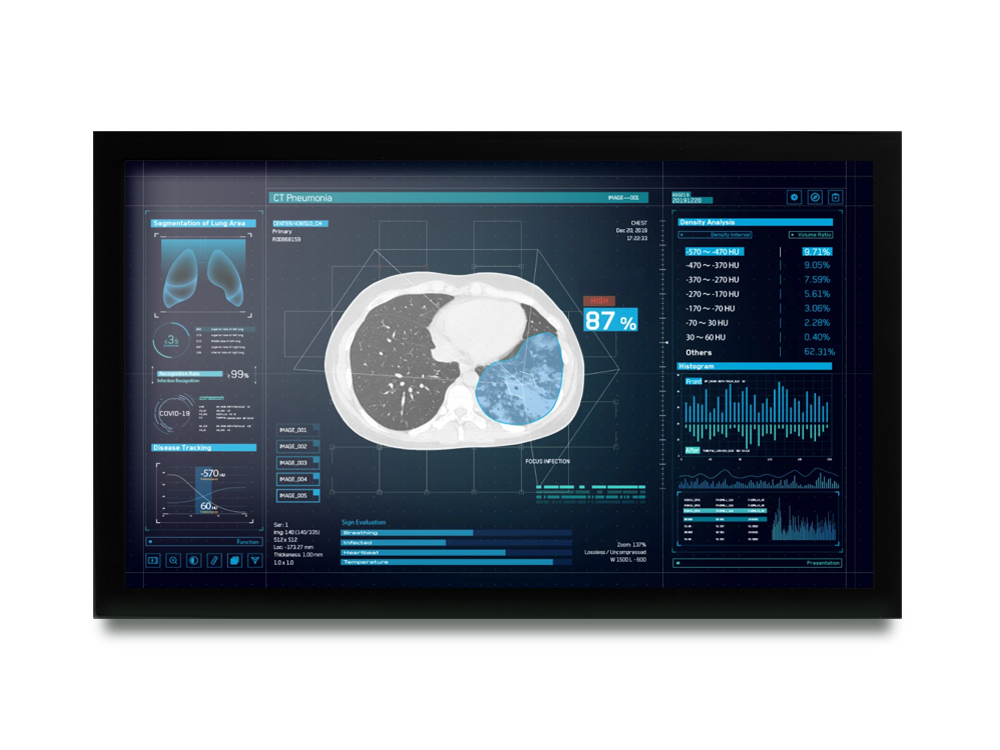 MEDDP-627 | Medical Display | Onyx Healthcare Inc.